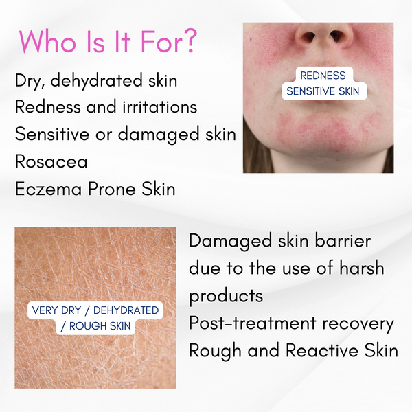 Skin Barrier Repair Serum – Ceramides & Probiotics Formula for ...
